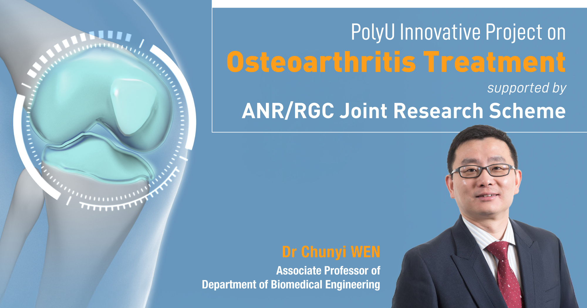 PolyU innovative project on osteoarthritis treatment supported by French National Research ...