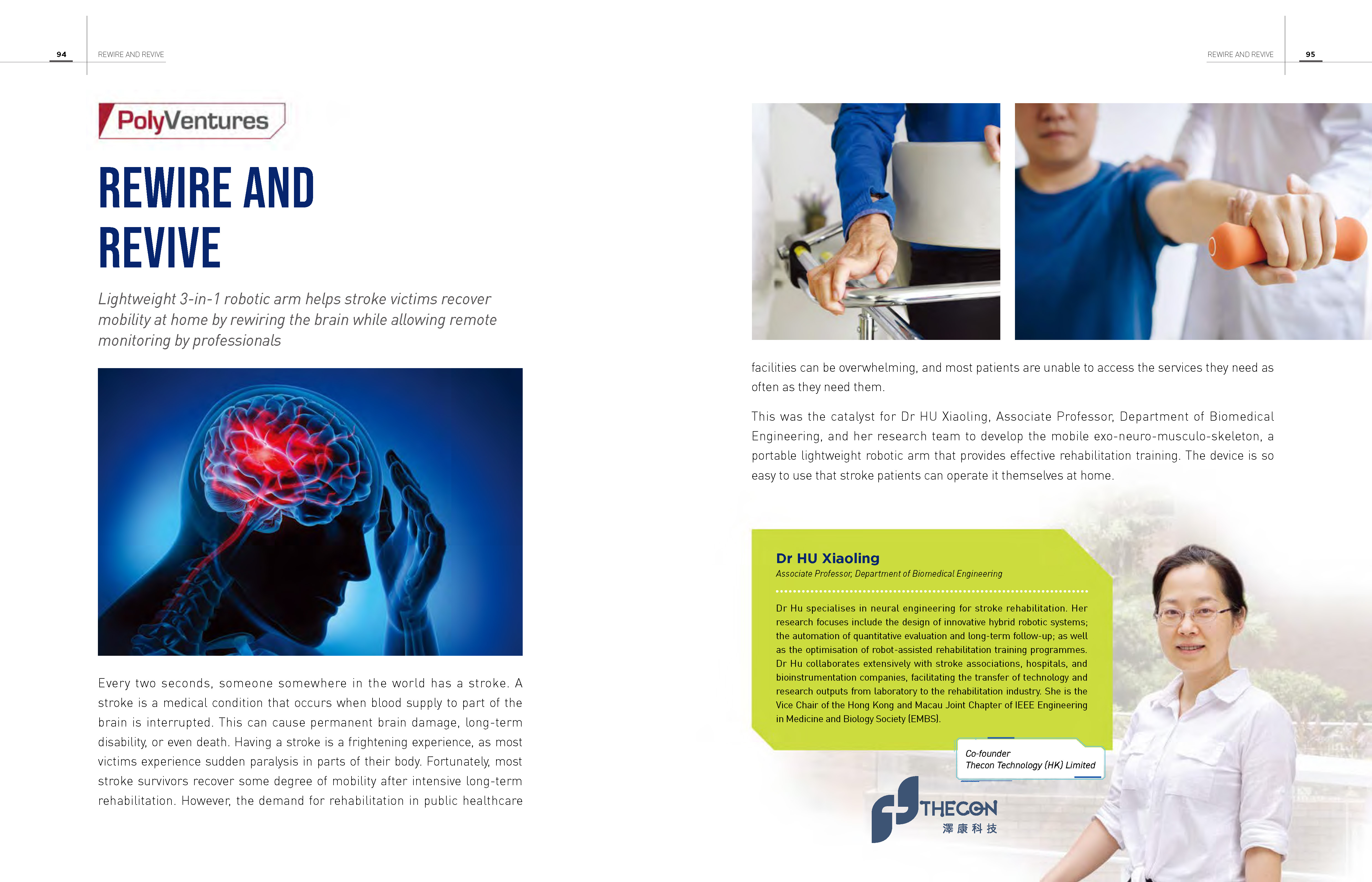 Rewire and Revive - Dr Xiaoling Hu | Department of Biomedical Engineering