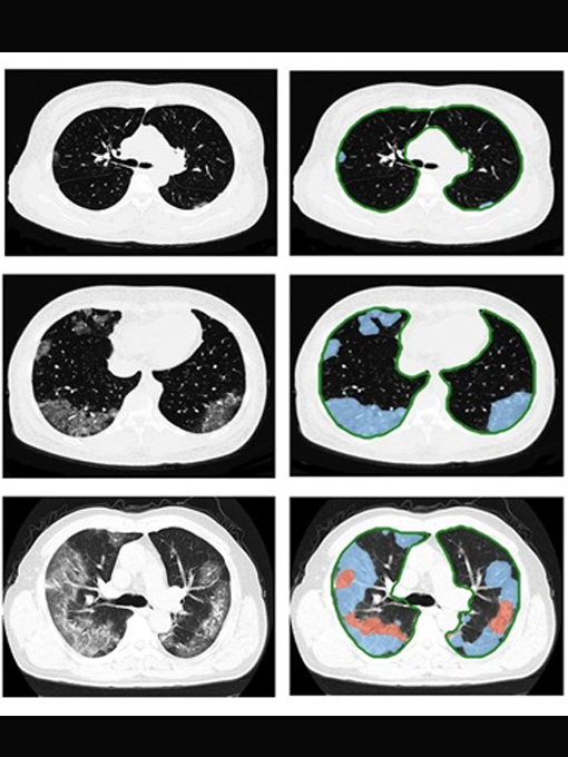Home | Combat COVID-19