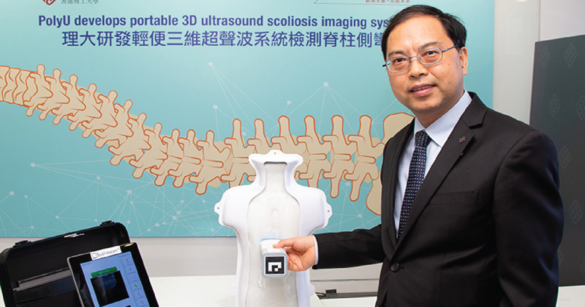 PolyU develops Palm-sized 3D Ultrasound Imaging System for Scoliosis ...