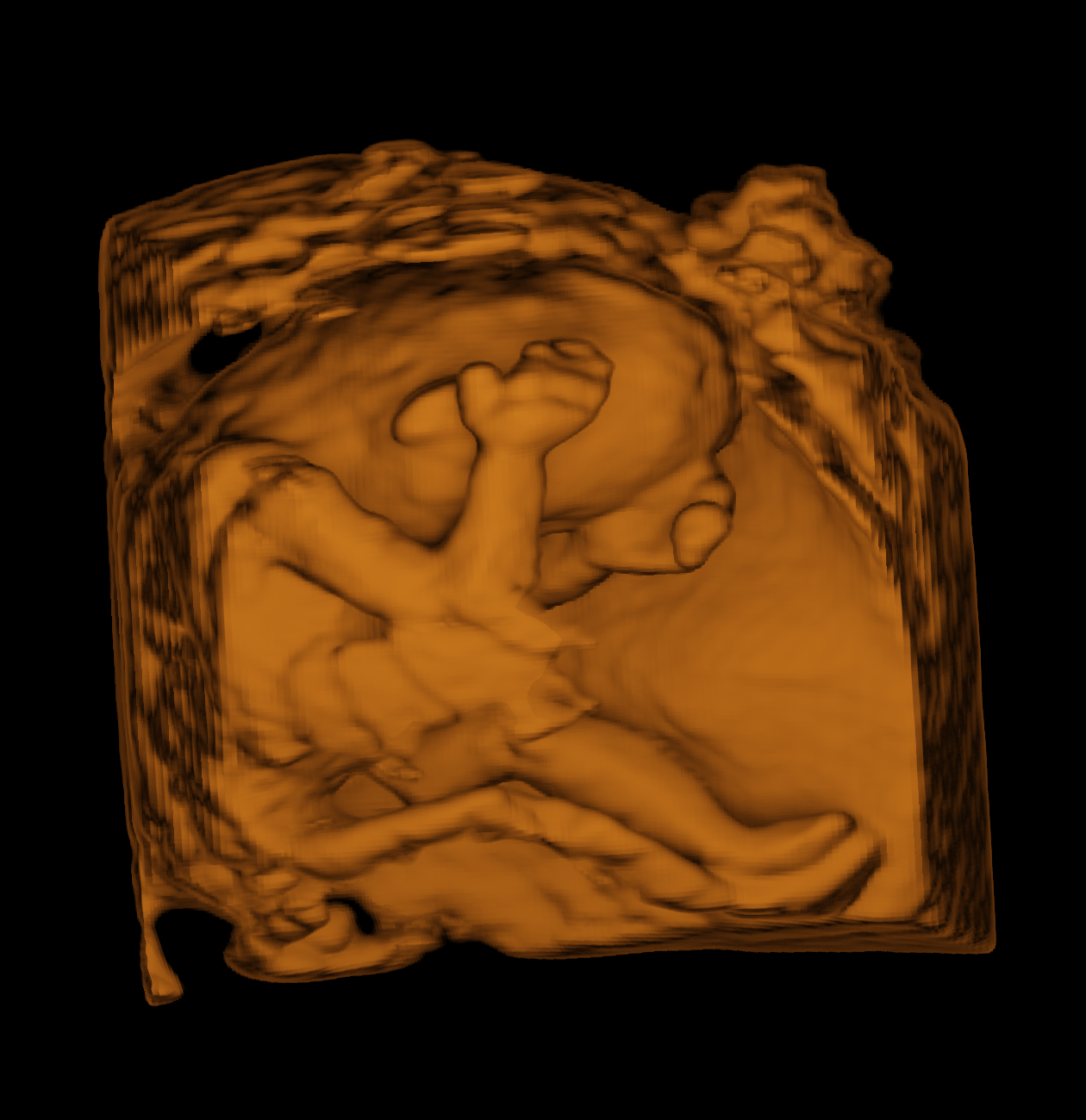 Real-time 3D Fetal Ultrasound Visualization System | Knowledge Transfer ...