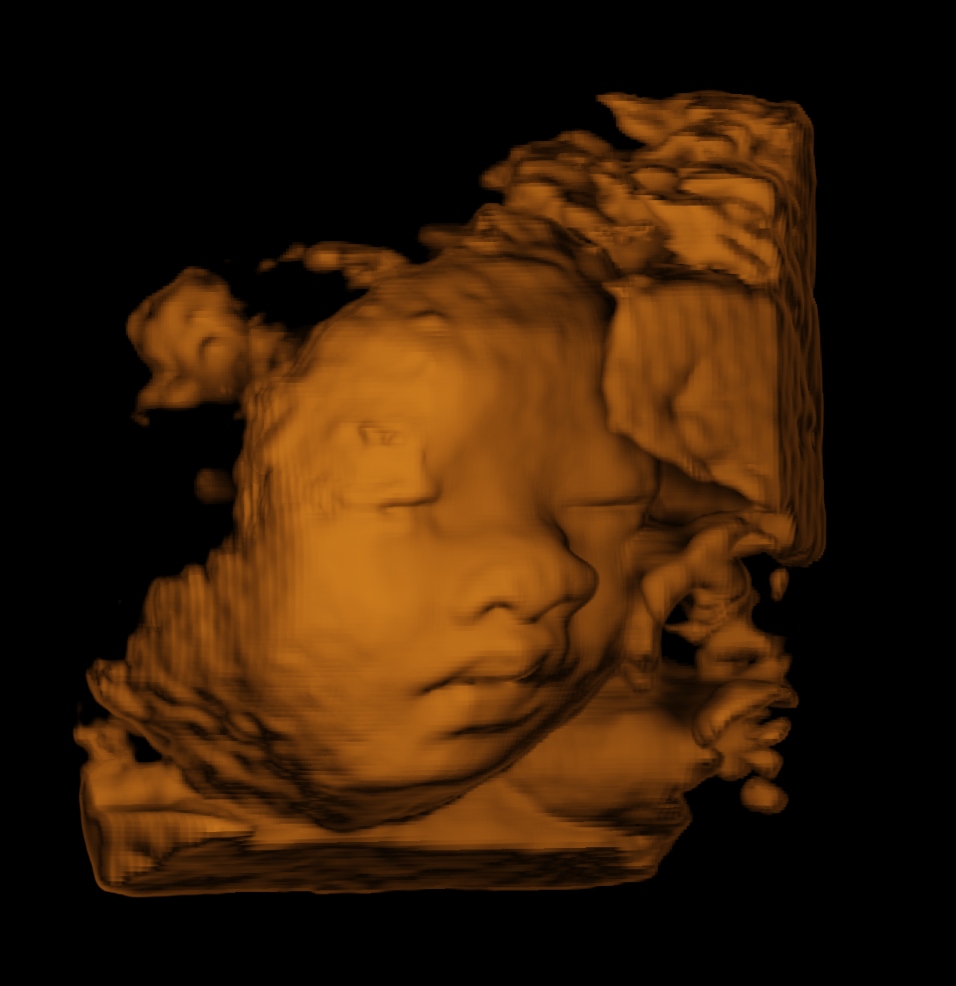 Real-time 3D Fetal Ultrasound Visualization System | Knowledge Transfer ...
