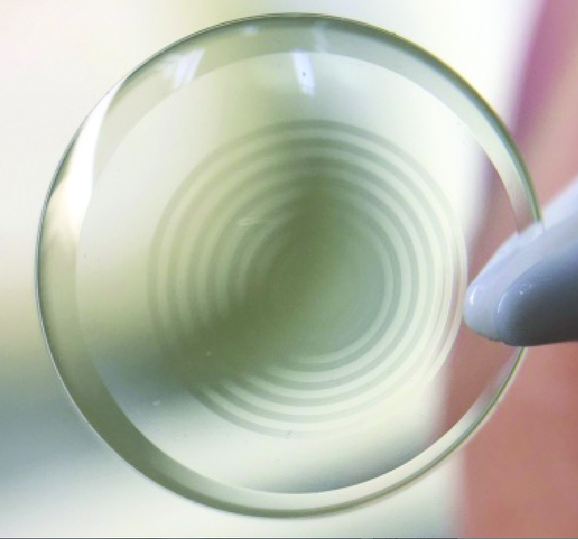 A Novel Optical Method for Retarding Myopia Progression | Knowledge ...