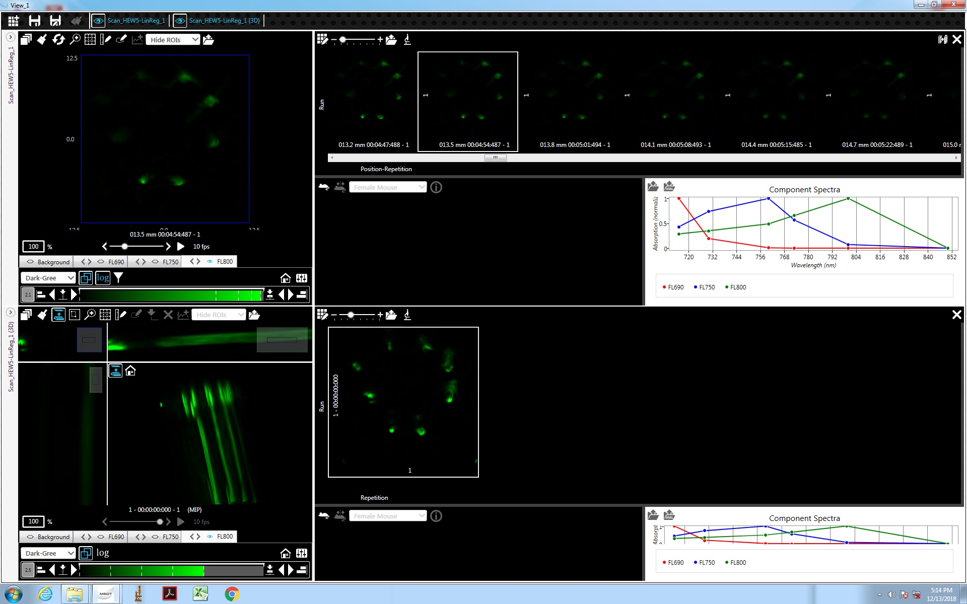 Photoacoustic Imaging Scanner for Real-time Anatomical, Functional and ...