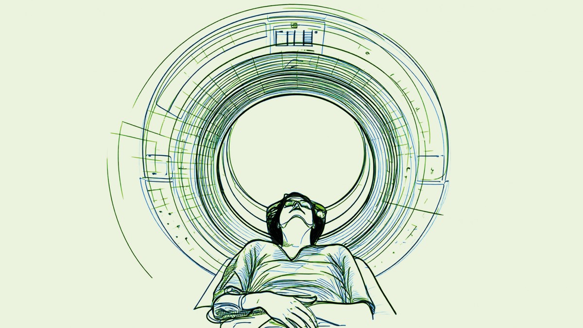 AI Innovation Means Safer Scans and Fewer Side Effects | May 2025 Issue ...