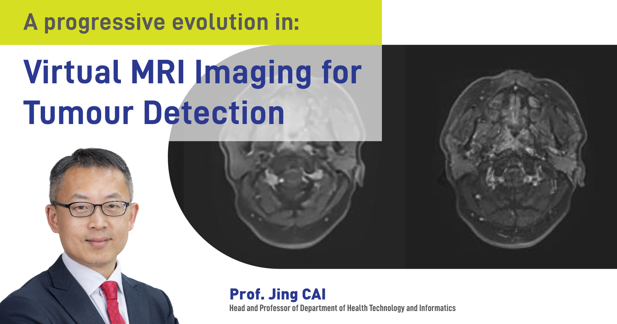A progressive evolution in virtual MRI imaging for tumour detection ...