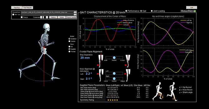Running Assessment Service | Rehabilitation Clinic