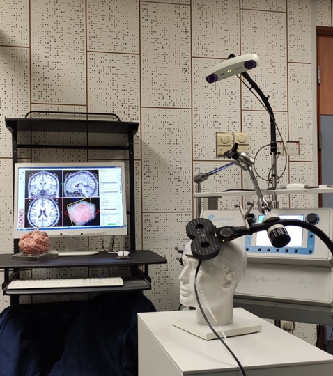 Brain Stimulation | UBSN